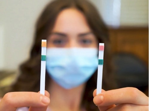Cavity pHighter Test Strips - BioMeDent